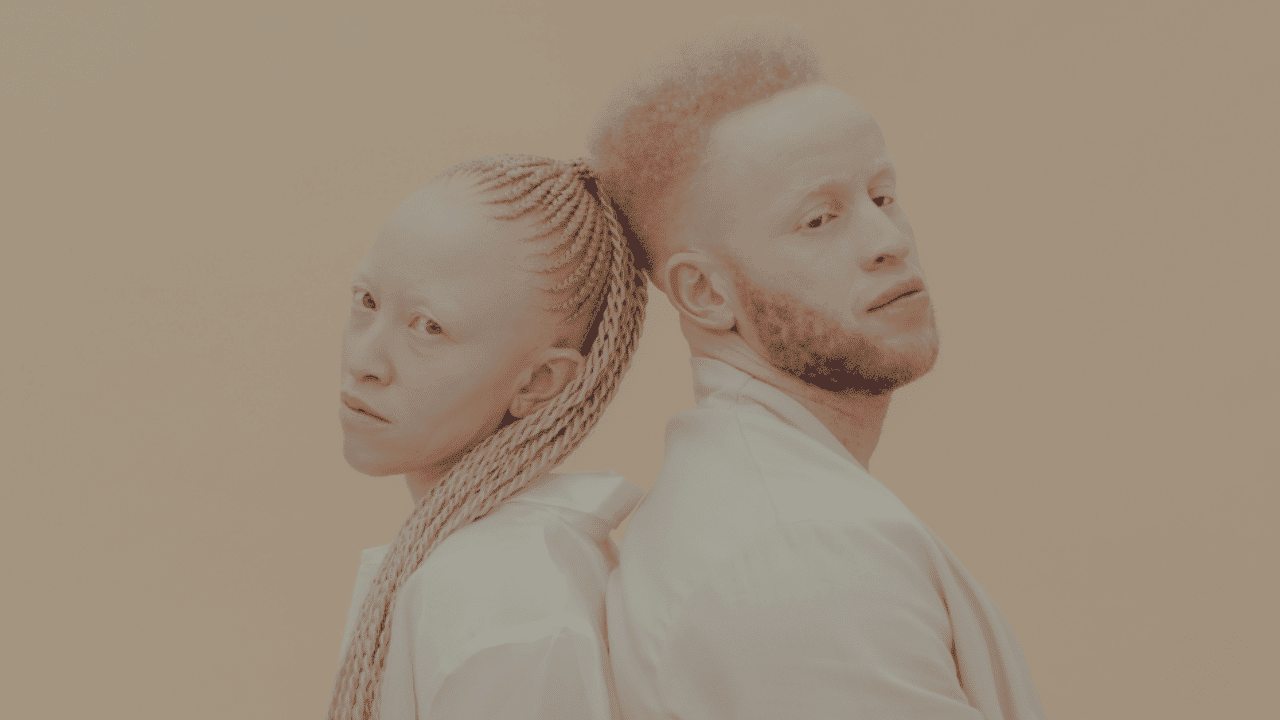 Albinism: Understanding The Genetic Disorder