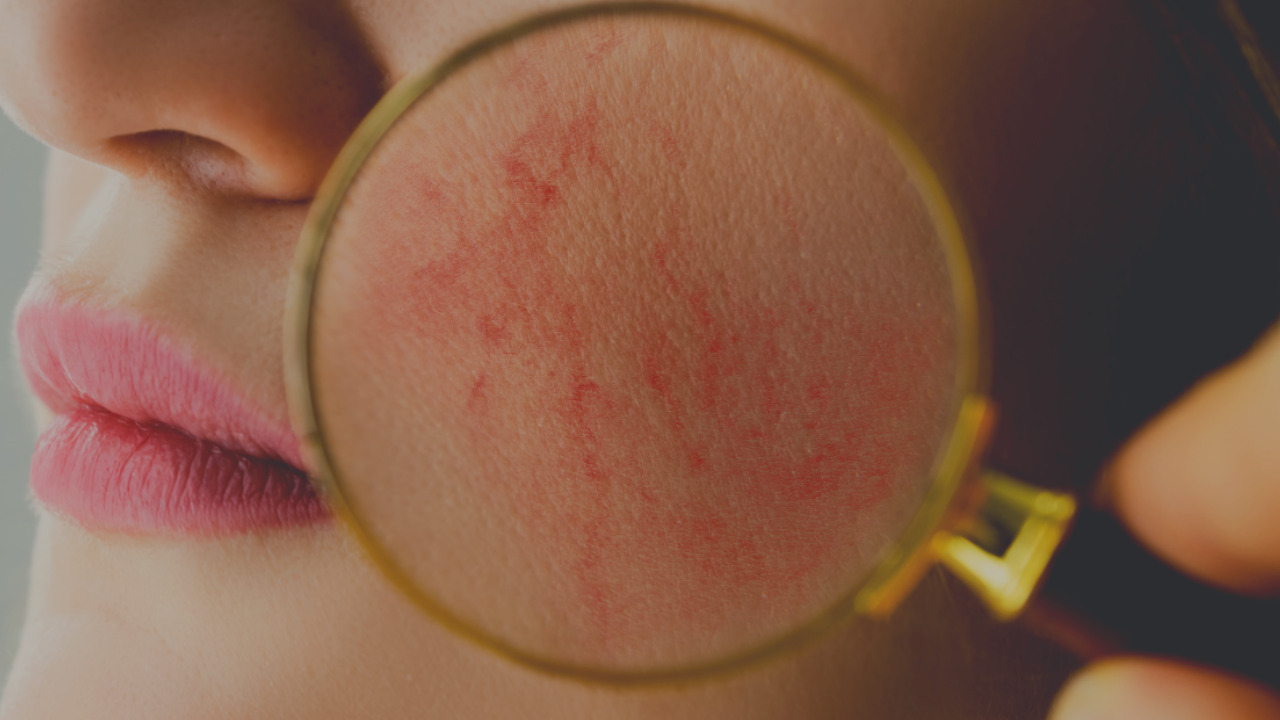 How to reverse damage caused by over-exfoliation? 7 Steps To Reverse ...